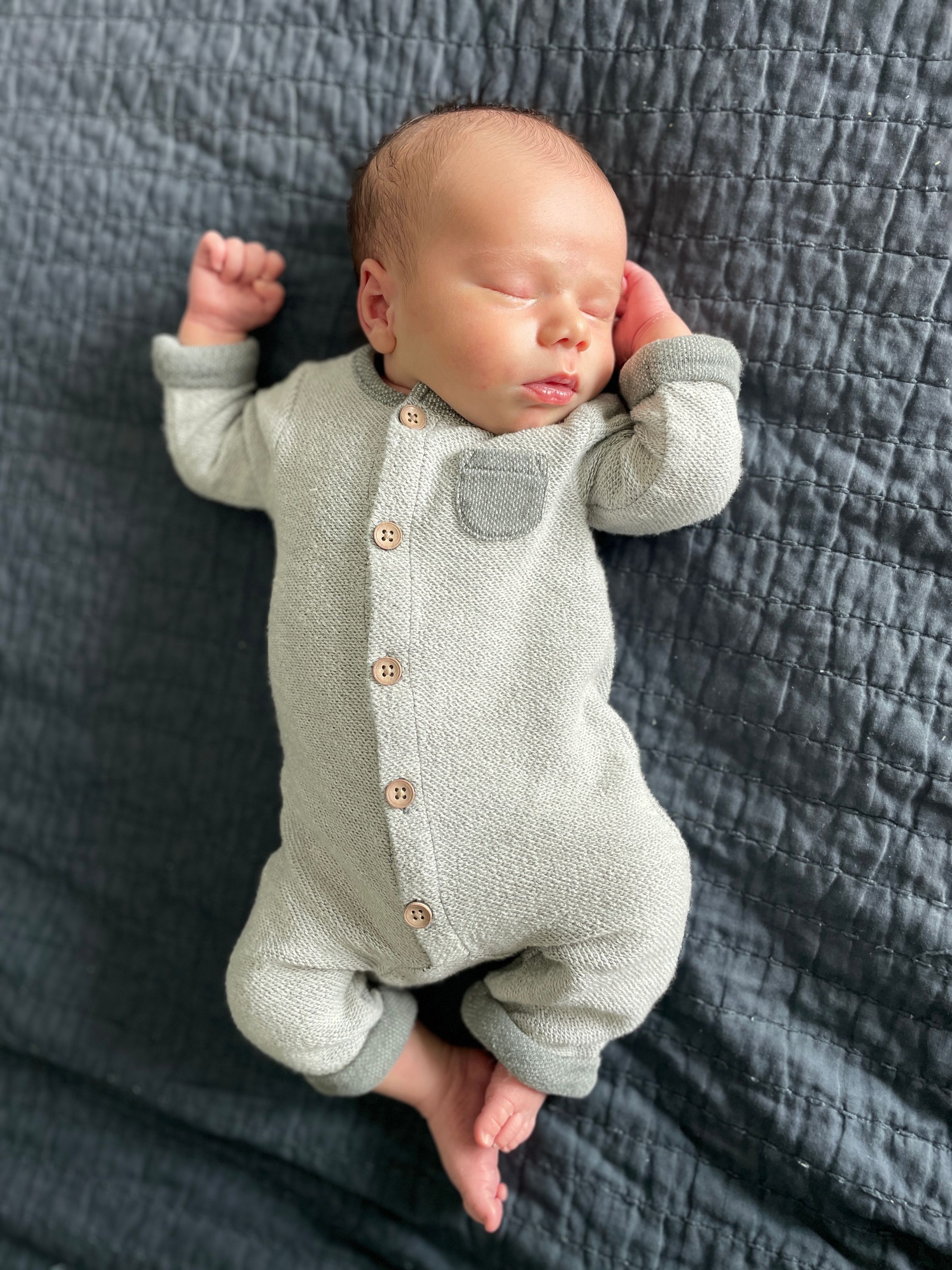 How to Manage Chaffing after Birth